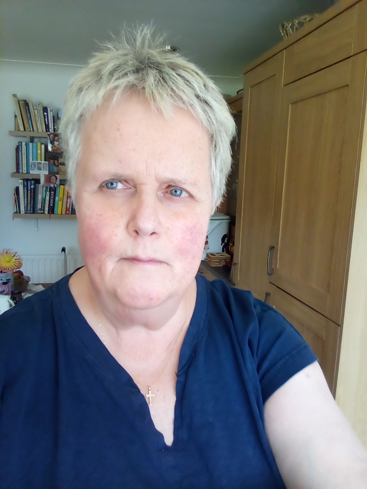 "I prefer to look at the positives of my illness" – Debra’s story